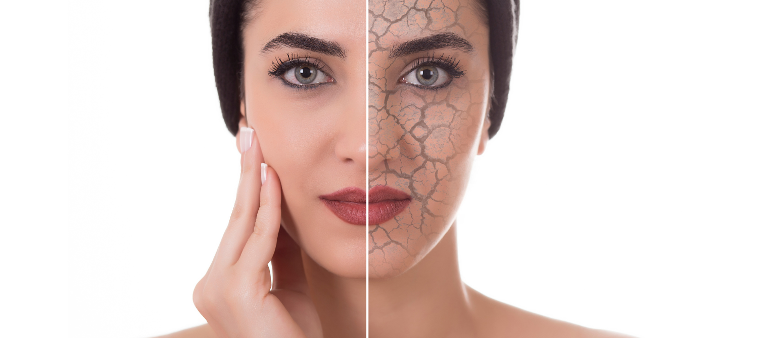Rough Dry Skin: Types, Risk Factors, and Treatments - Areton
