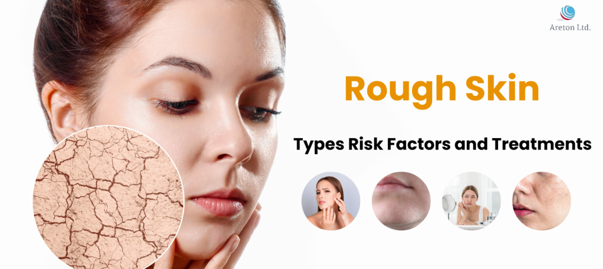 Rough Dry Skin: Types, Risk Factors, and Treatments - Areton