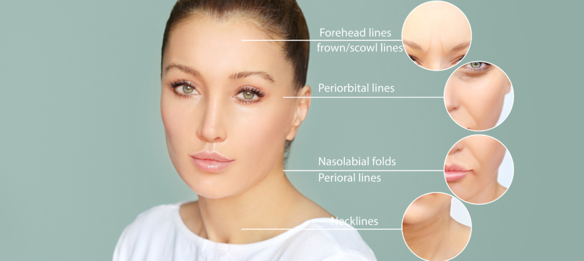 Frown Lines: Causes, treatment options, and more - Areton