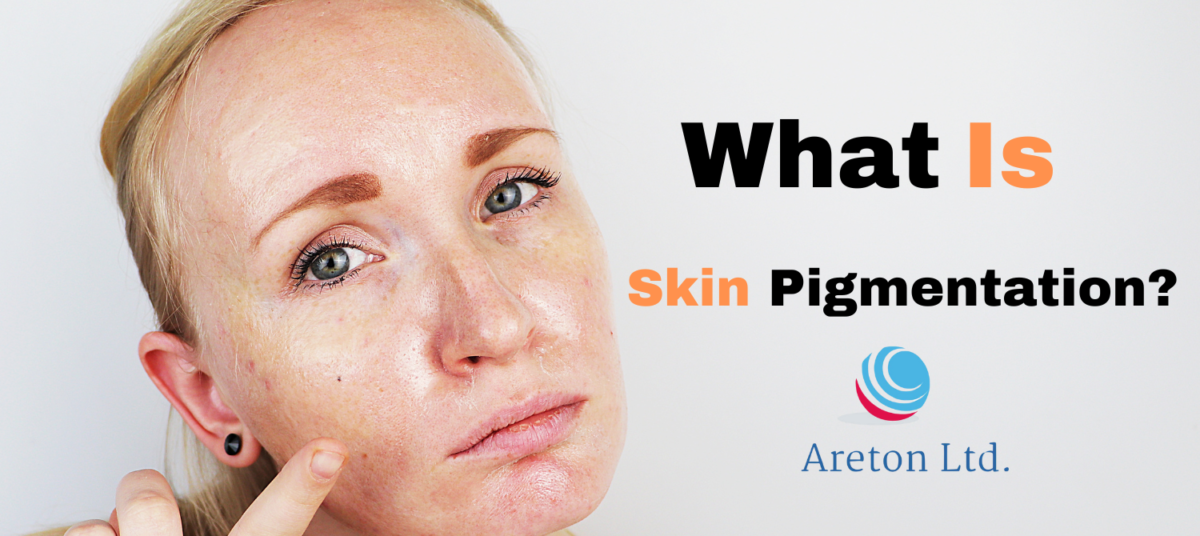 Skin Pigmentation: Causes & Treatments - Areton